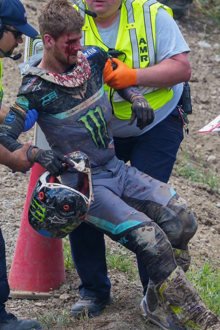 Michael Mosiman Injury Update After Brutal Unadilla Crash!